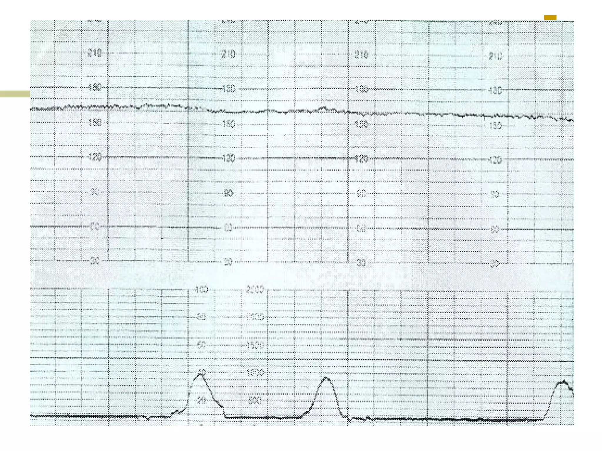Cardiotocography (CTG) | PPT