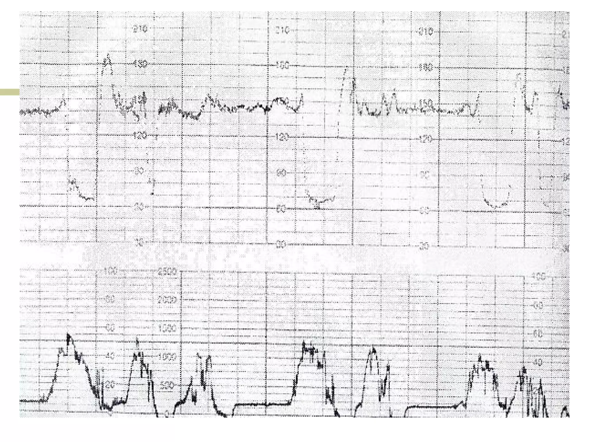 Cardiotocography (CTG) | PPT | Pregnancy | Reproductive Health