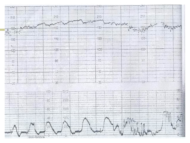 Cardiotocography (CTG) | PPT | Pregnancy | Reproductive Health