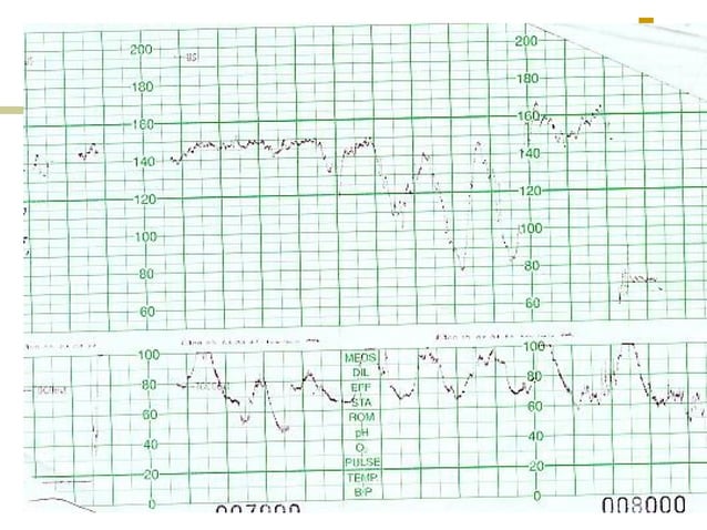 Cardiotocography (CTG) | PPT | Pregnancy | Reproductive Health