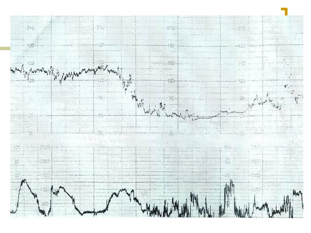 Cardiotocography (CTG) | PPT | Pregnancy | Reproductive Health