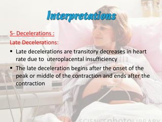 Cardiotocography | PDF | Pregnancy | Reproductive Health