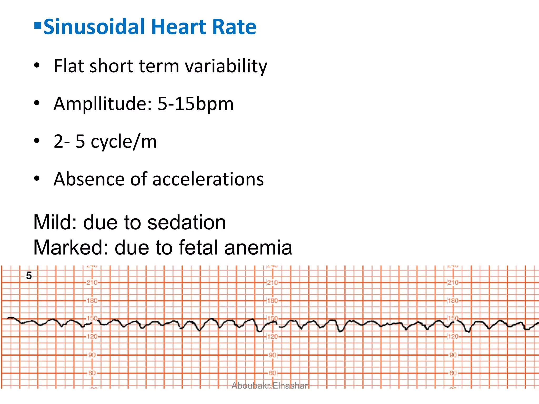 Cardiotocography: CTG antepartum and intrapartum | PDF