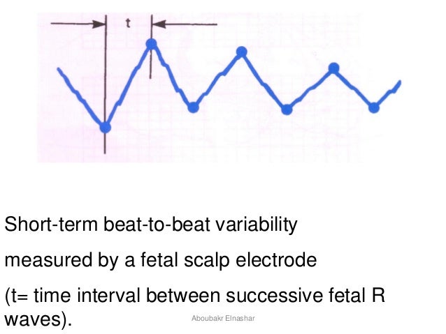 Cardiotocography: CTG antepartum and intrapartum