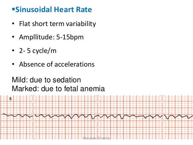 Cardiotocography: CTG antepartum and intrapartum