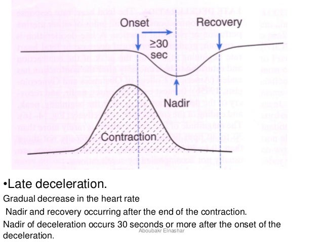 Cardiotocography: CTG antepartum and intrapartum