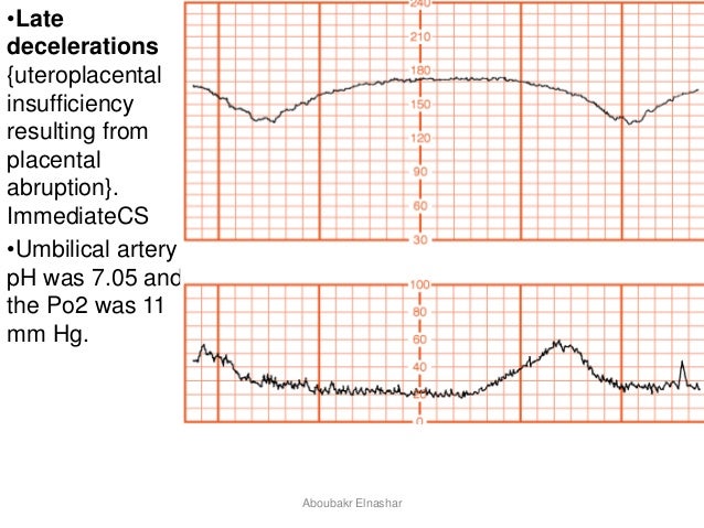 Cardiotocography: CTG antepartum and intrapartum