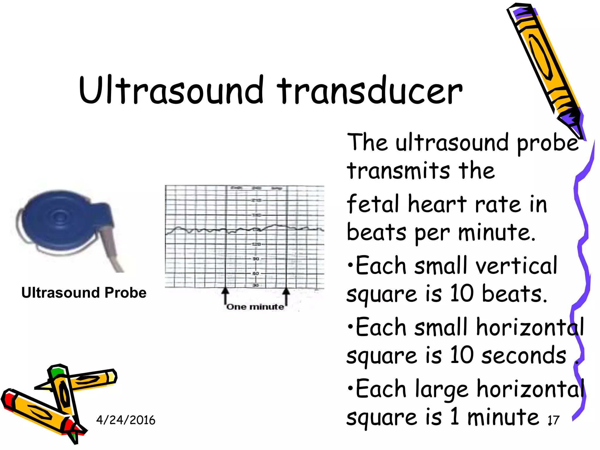 Cardiotocography | PPTX