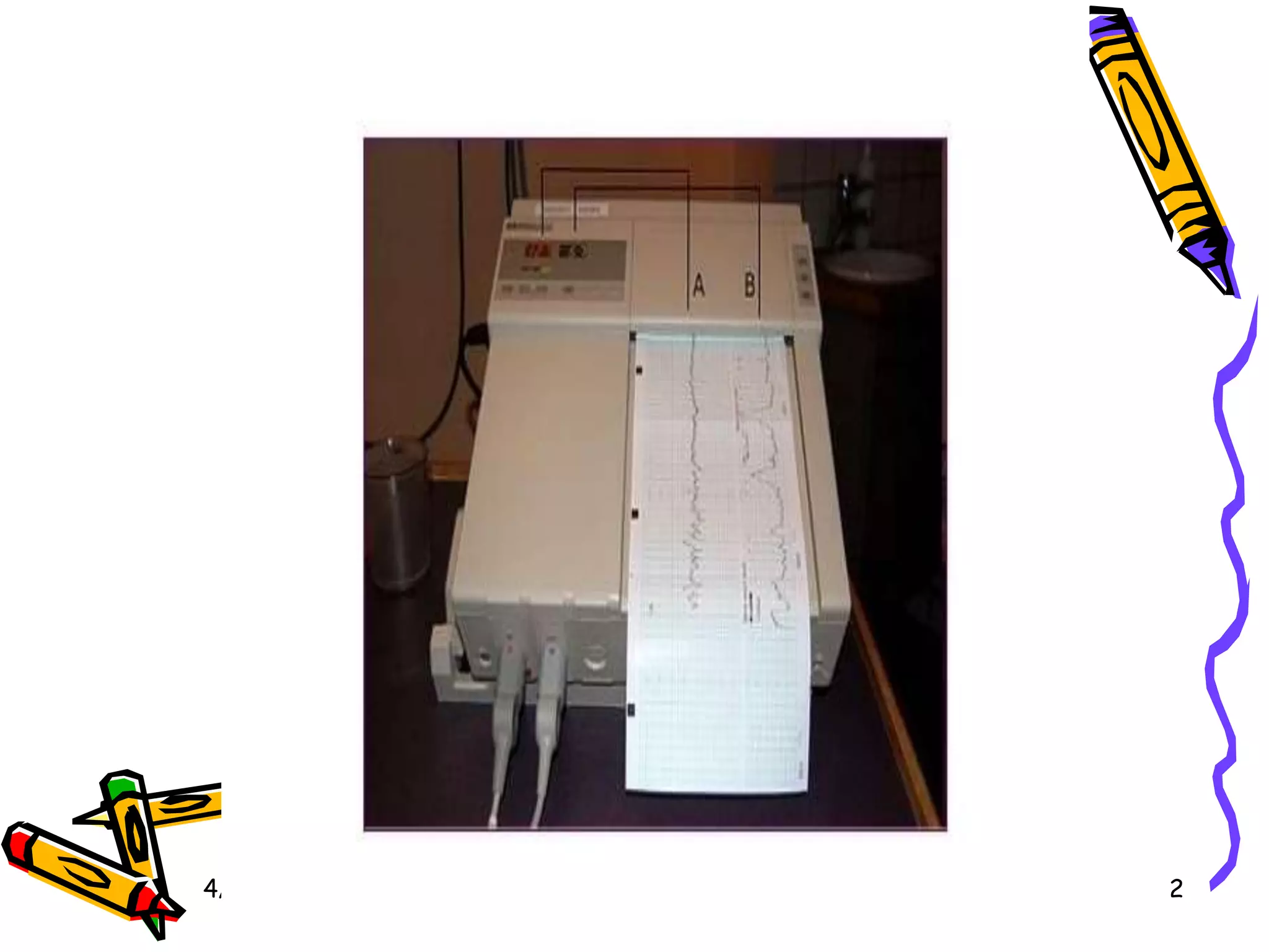 Cardiotocography | PPTX
