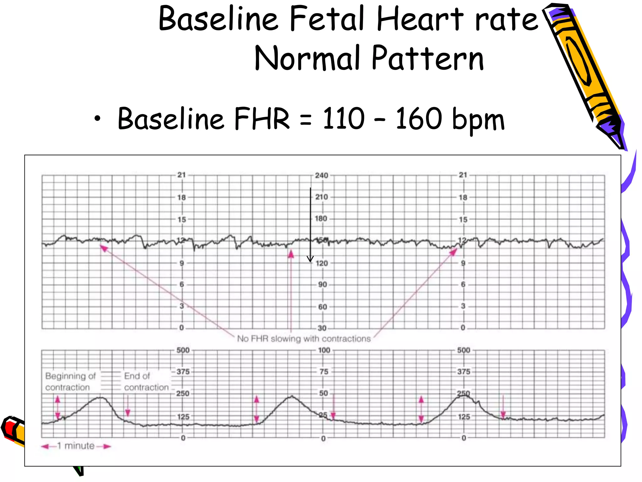 Cardiotocography | PPTX