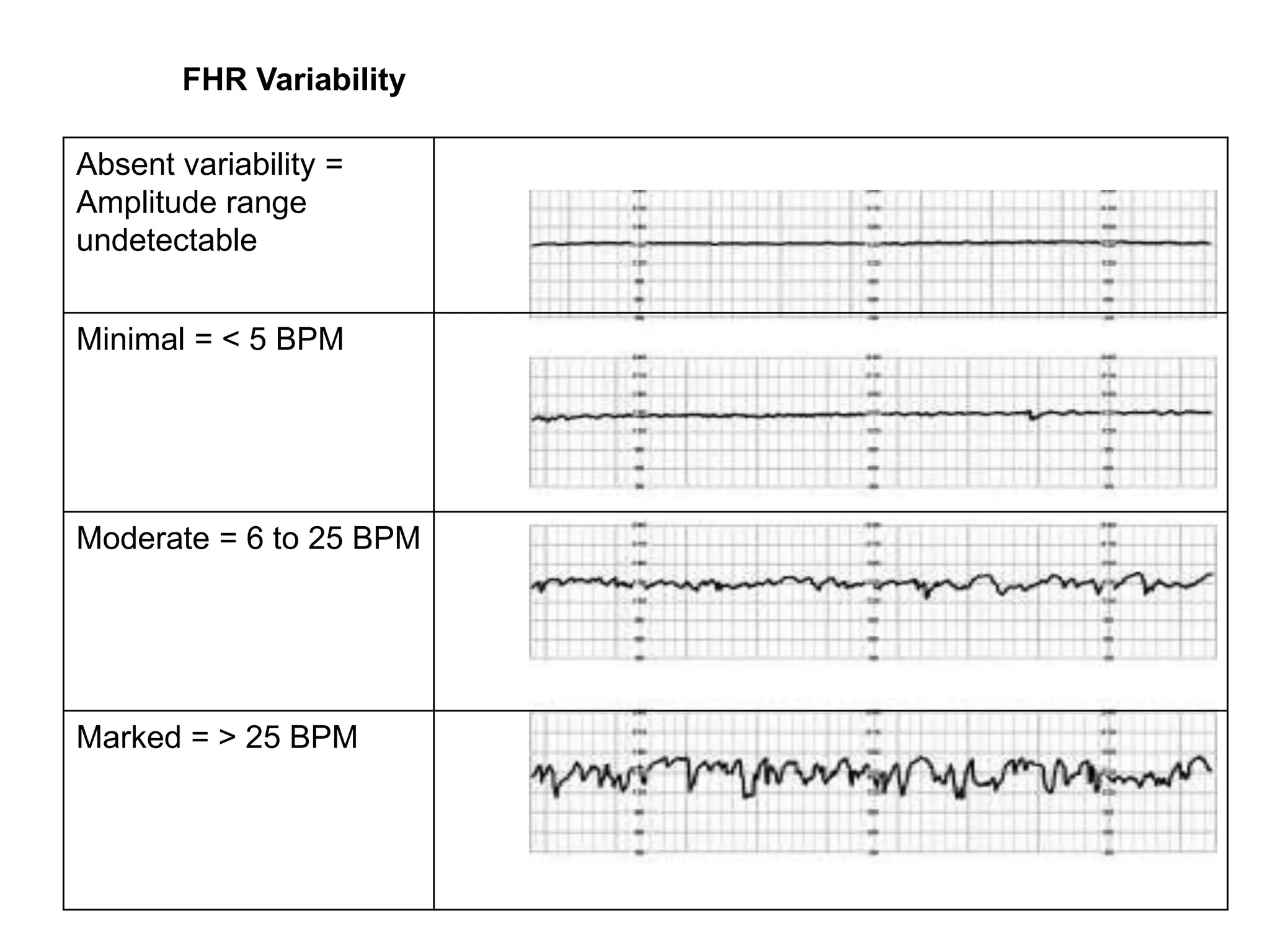 Cardiotocography | PPTX