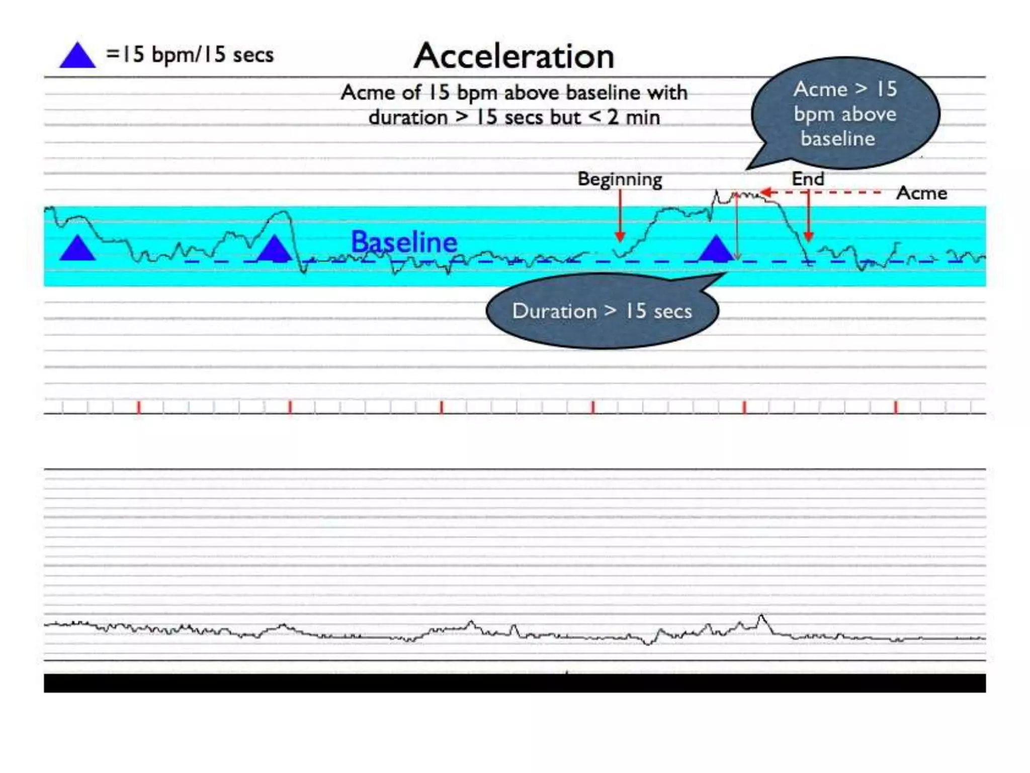 Cardiotocography | PPTX