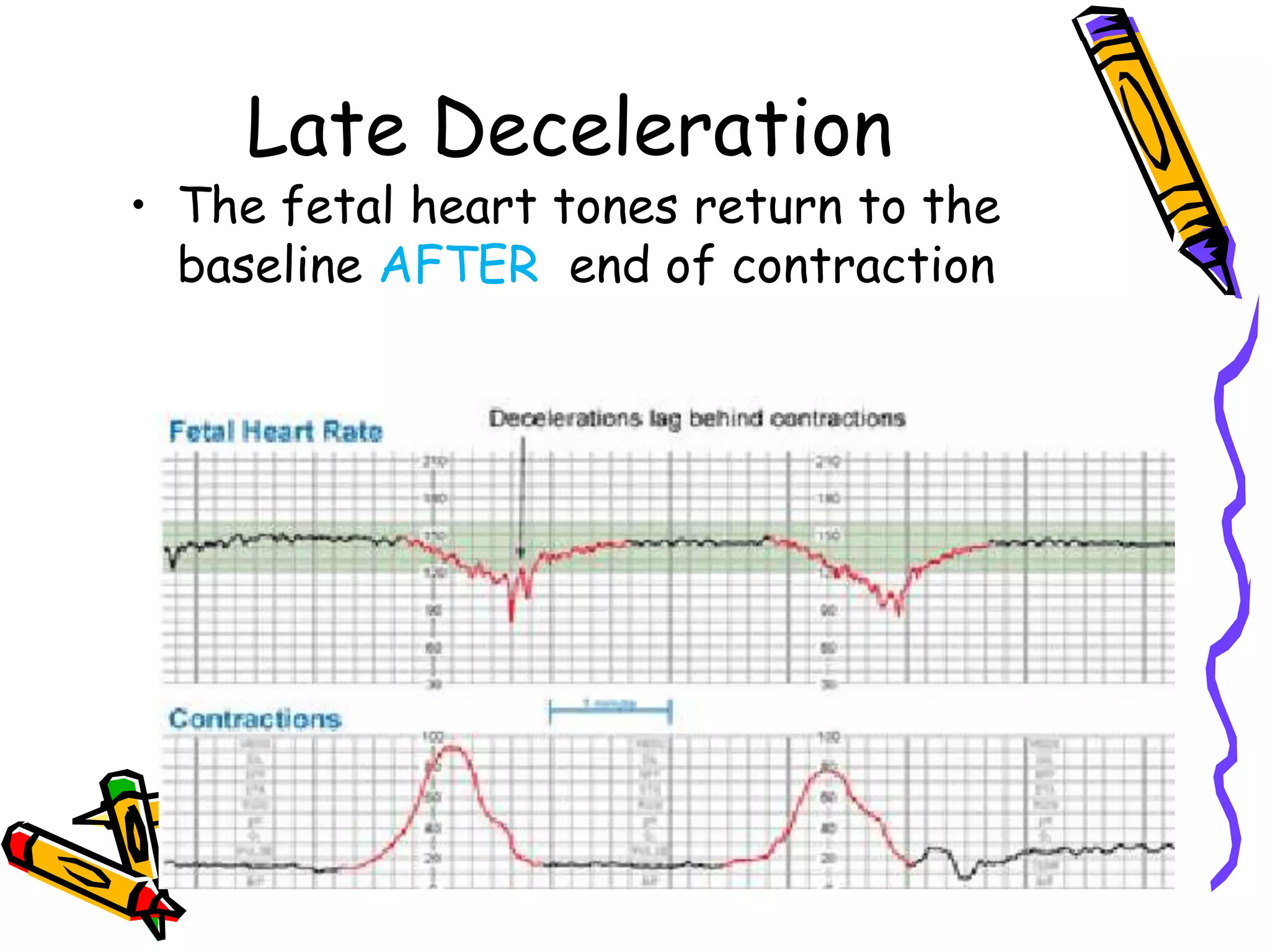 Cardiotocography | PPTX