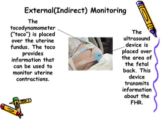 Cardiotocography | PPTX