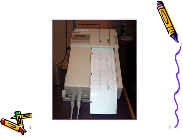 Cardiotocography | PPTX | Pregnancy | Reproductive Health