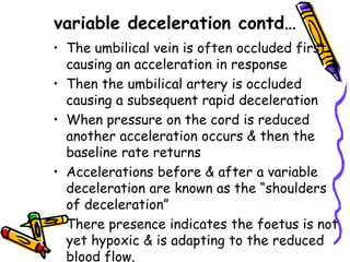 Deceleration Definition