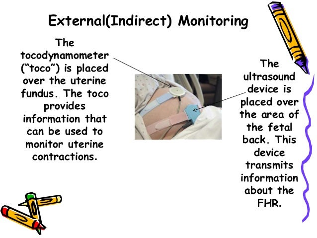 Cardiotocography