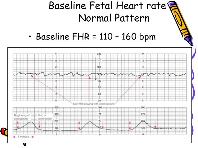 Cardiotocography