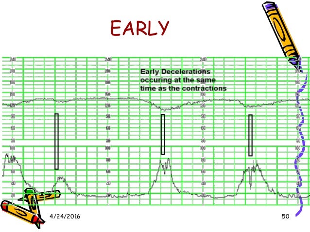 Cardiotocography