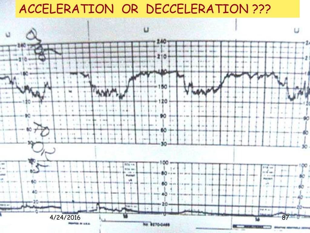 Cardiotocography