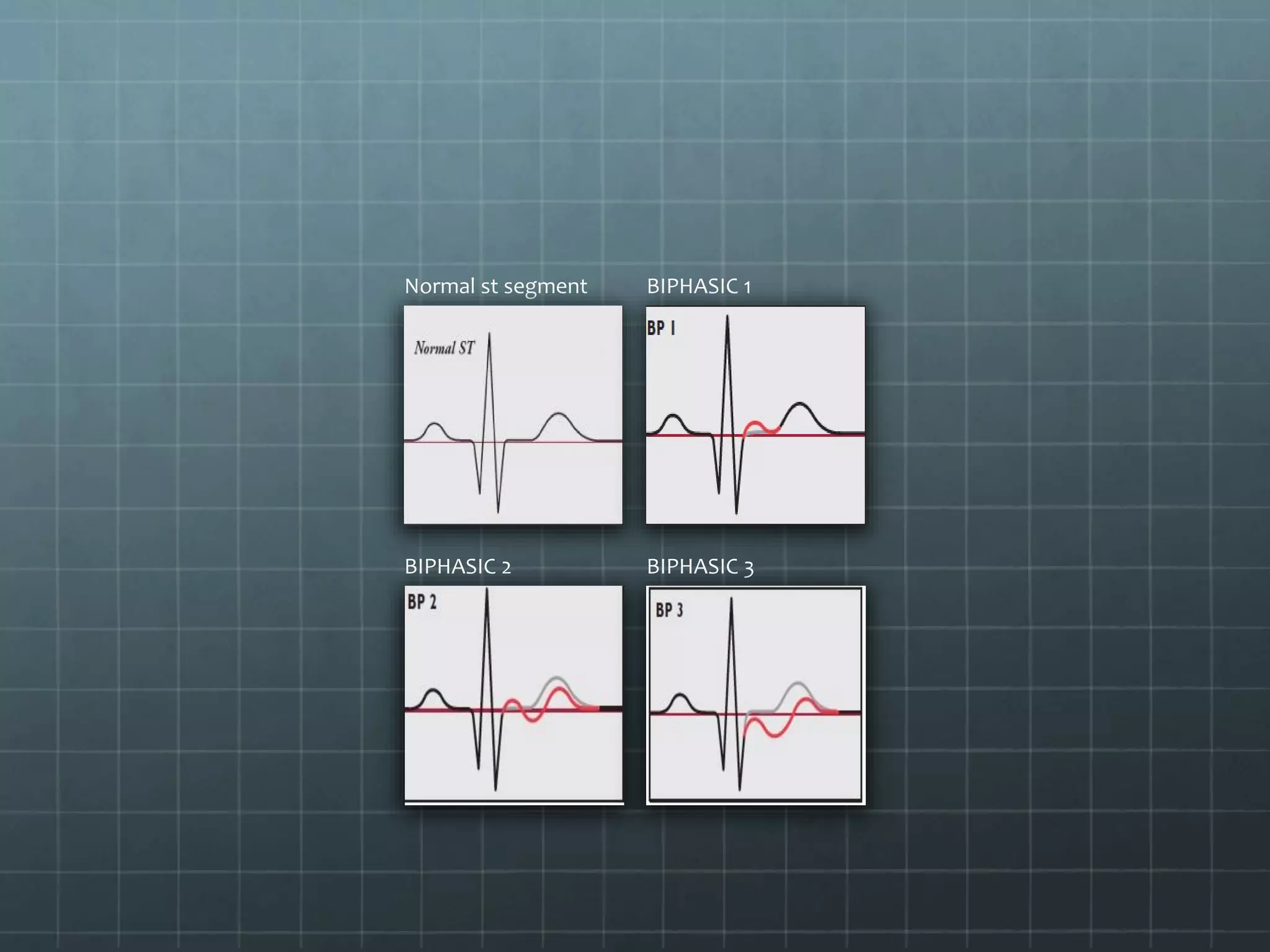 Cardiotocography | PDF