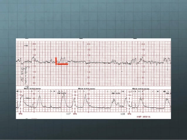 Cardiotocography