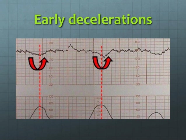 Cardiotocography