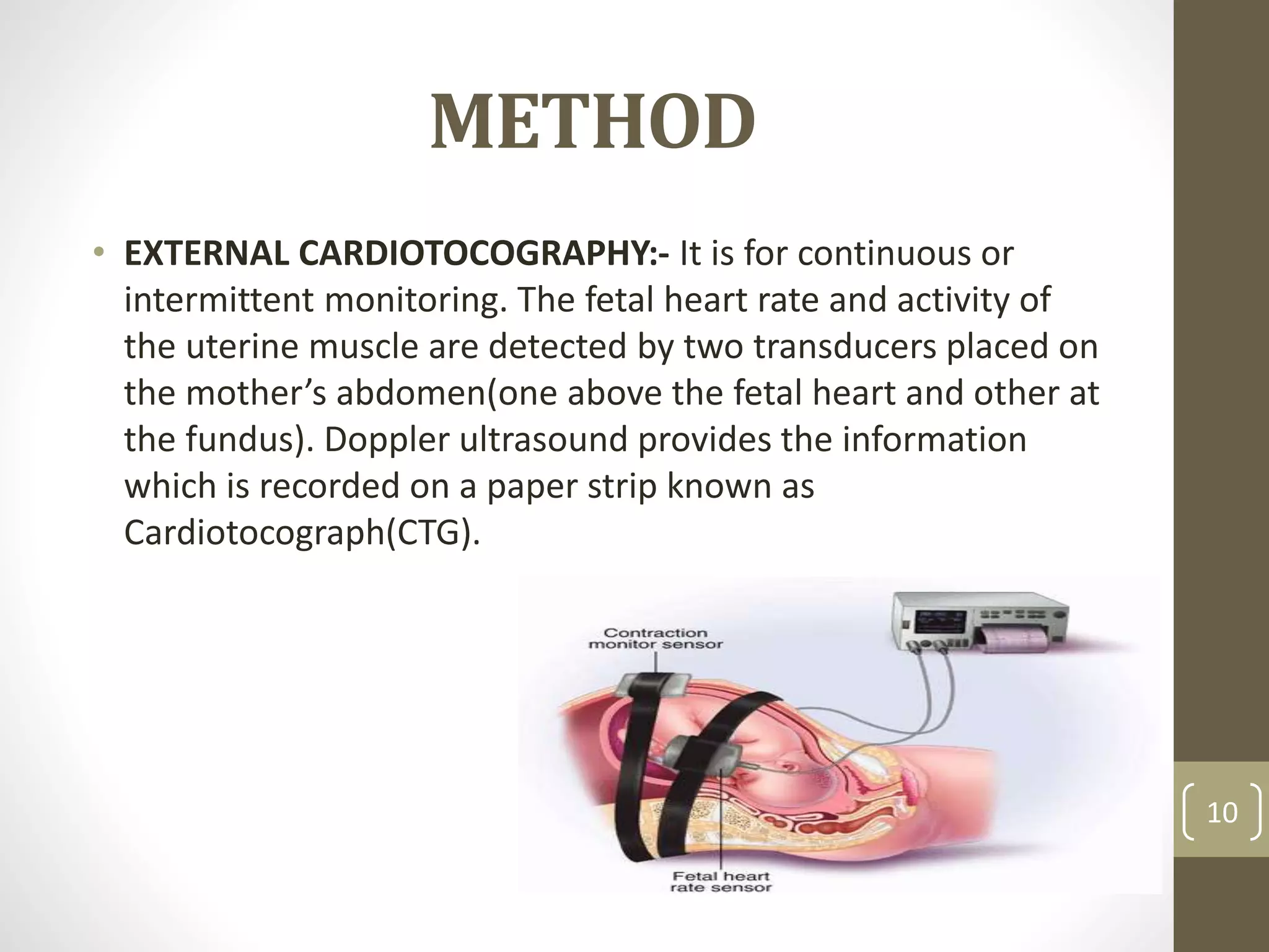 Cardiotocography | PPTX