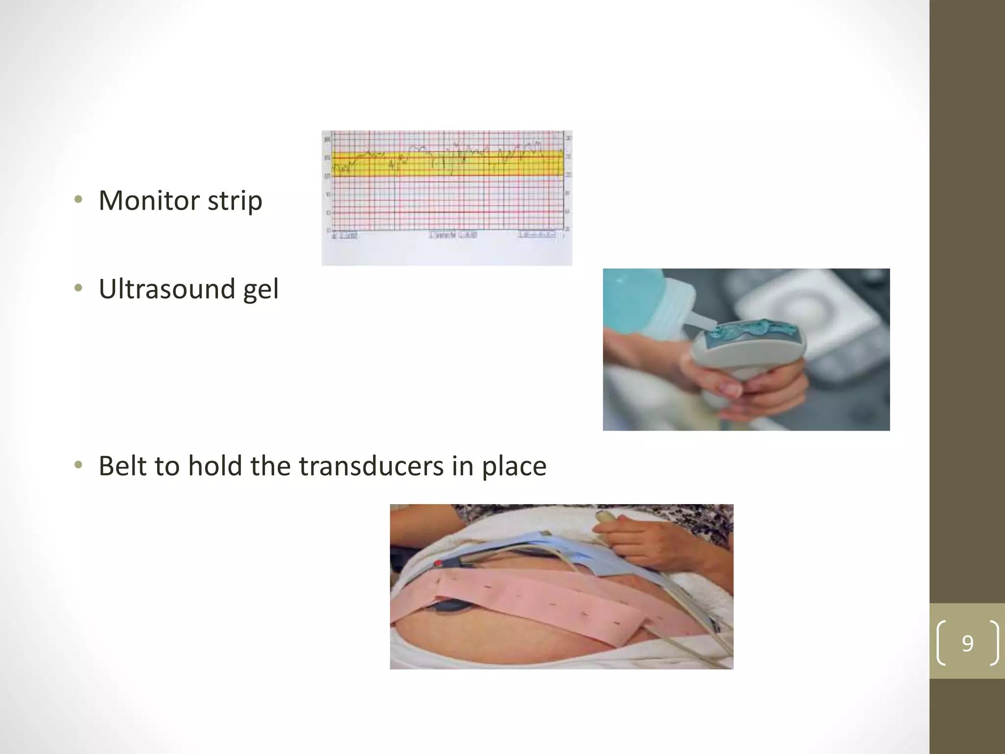 Cardiotocography | PPTX