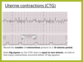 CTG .pptx