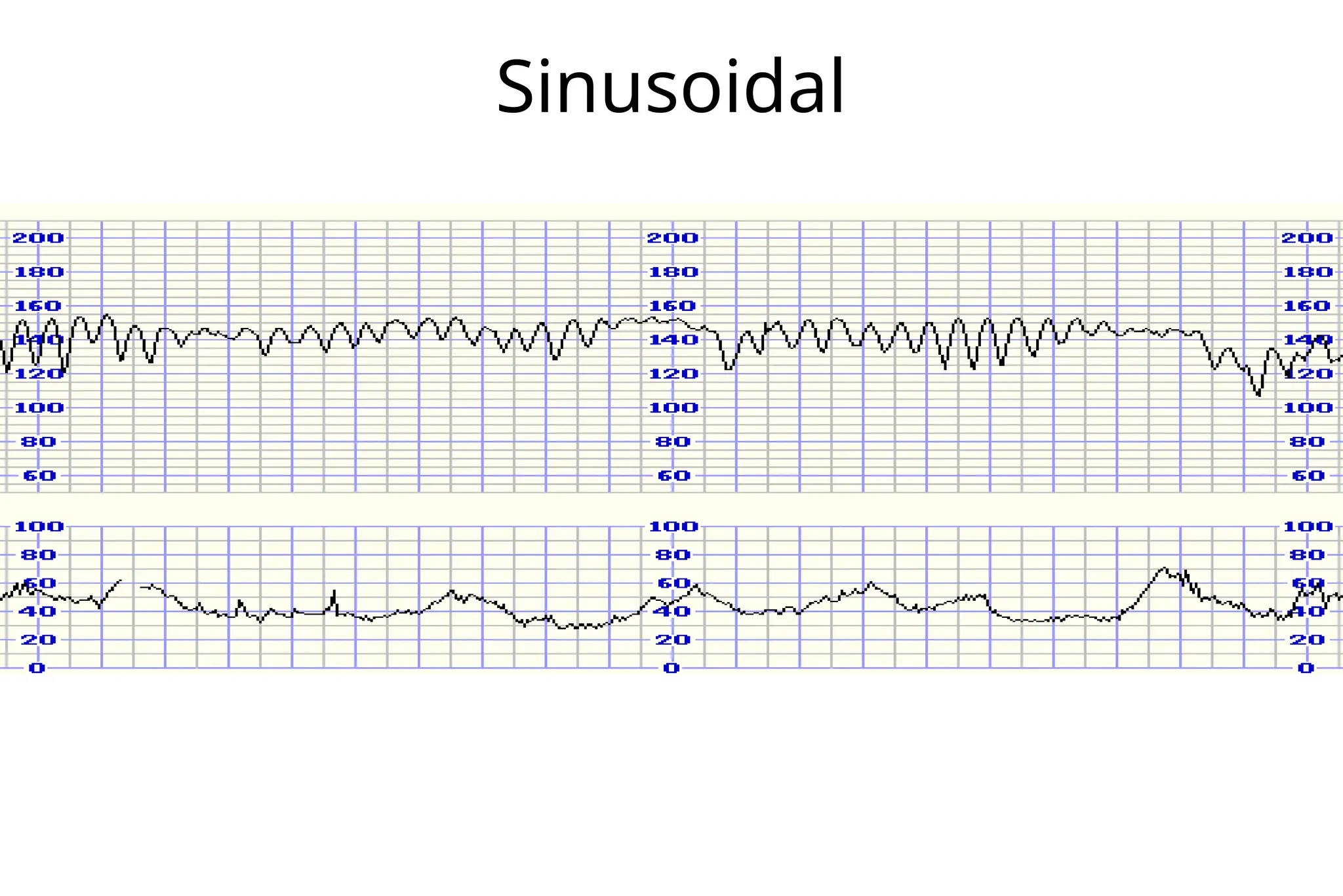 CTG INTERPERITATION POWERPOINT PRESENTATION | PPTX