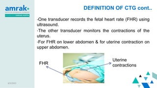 CTG presentation.pptx