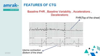 CTG presentation.pptx