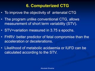 CTG: Antepartum | PPT