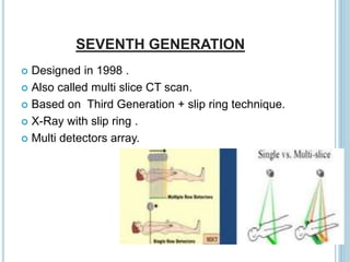 Basic of CT- scan Generation / Radiology | PPTX | Medical Tests ...