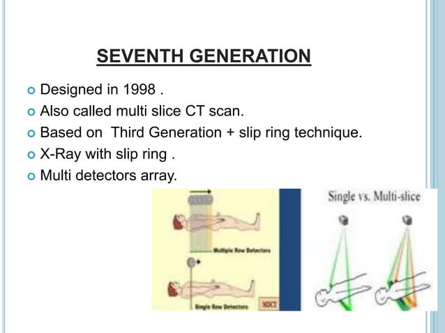 Basic of CT- scan Generation / Radiology | PPTX | Medical Tests ...