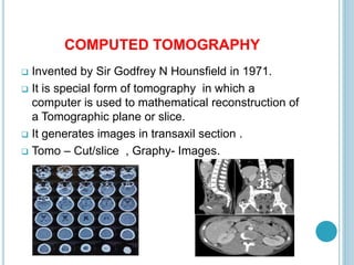 Basic of CT- scan Generation / Radiology | PPTX | Medical Tests ...