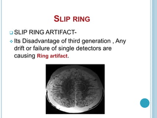 Basic of CT- scan Generation / Radiology | PPTX | Medical Tests ...