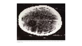 GENERATIONS OF COMPUTED TOMOGRAPHY | PPTX