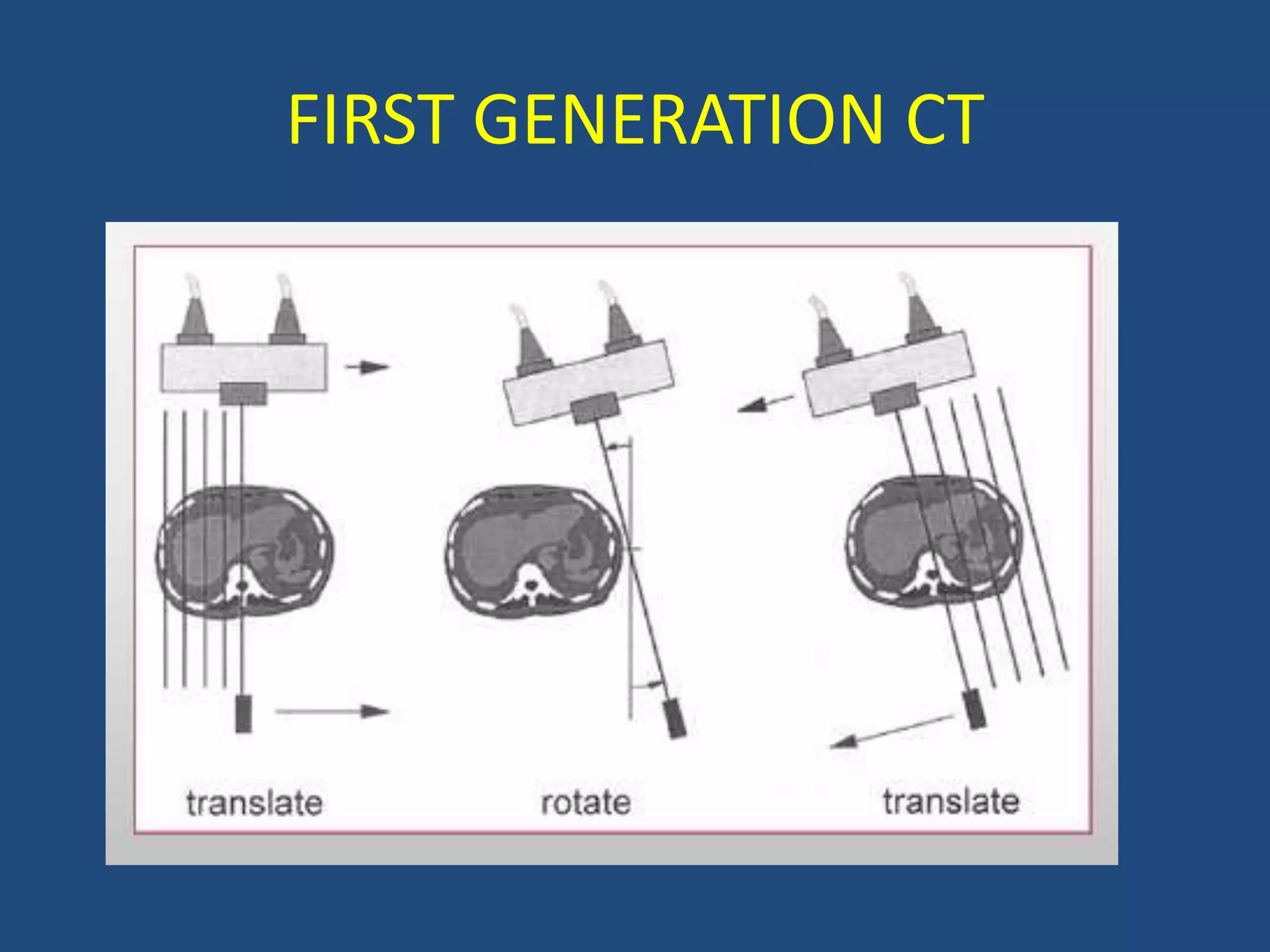 CT Generation (Generation of CT) | PPTX