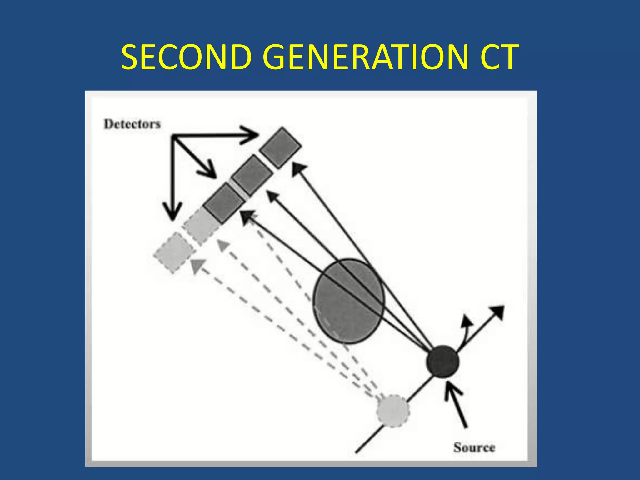 CT Generation (Generation of CT) | PPTX