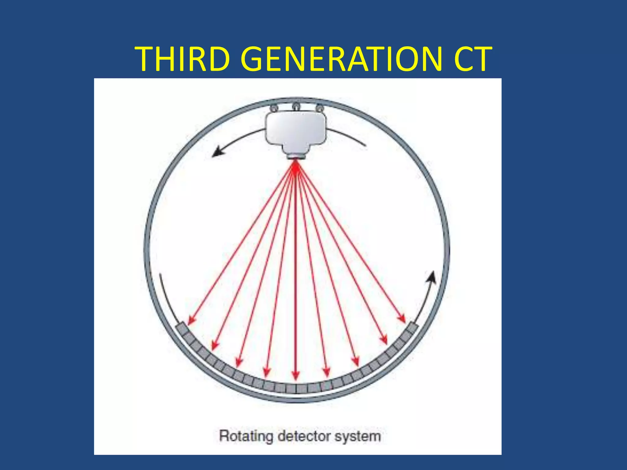 CT Generation (Generation of CT) | PPTX