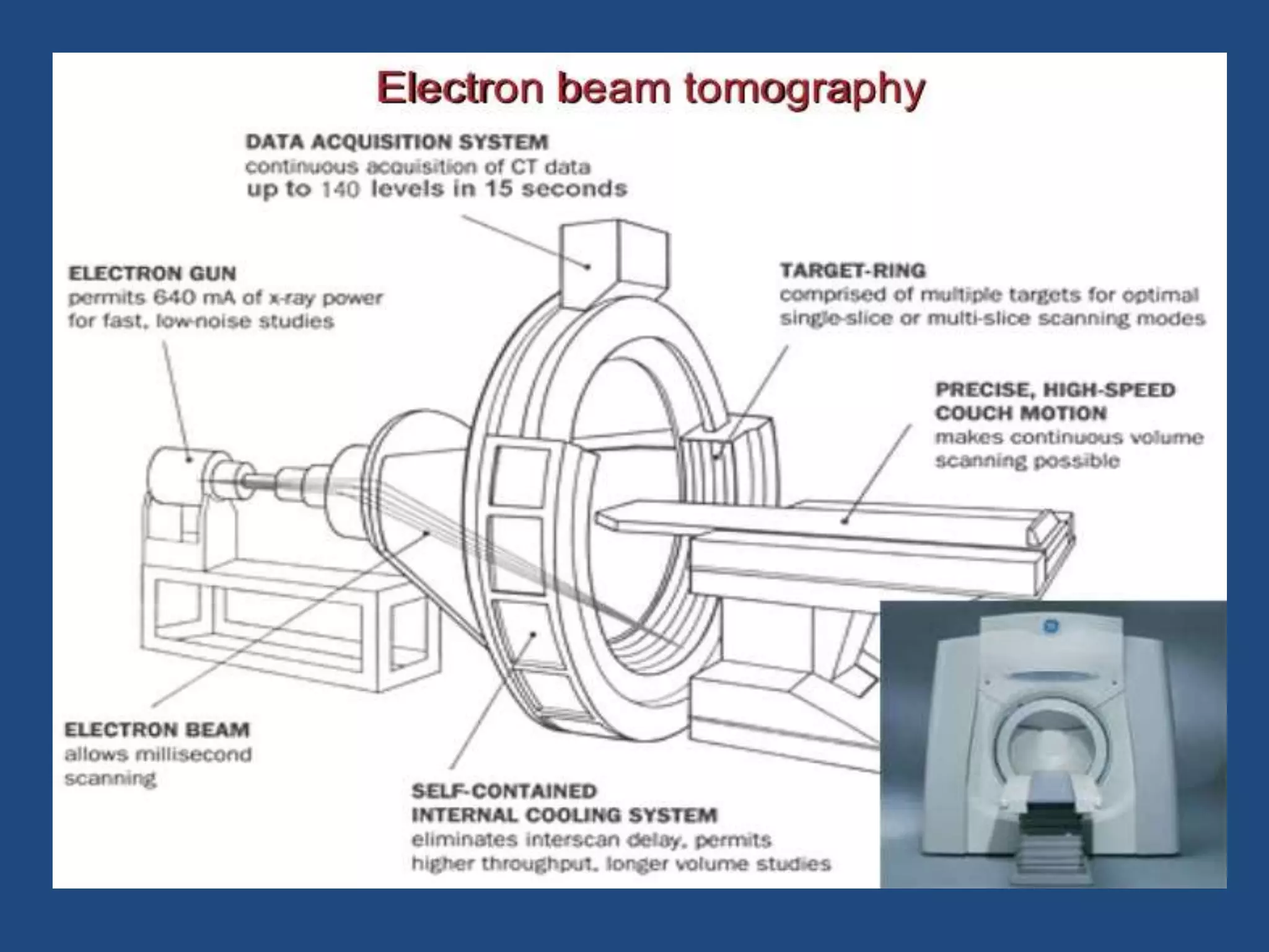 CT Generation (Generation of CT) | PPTX