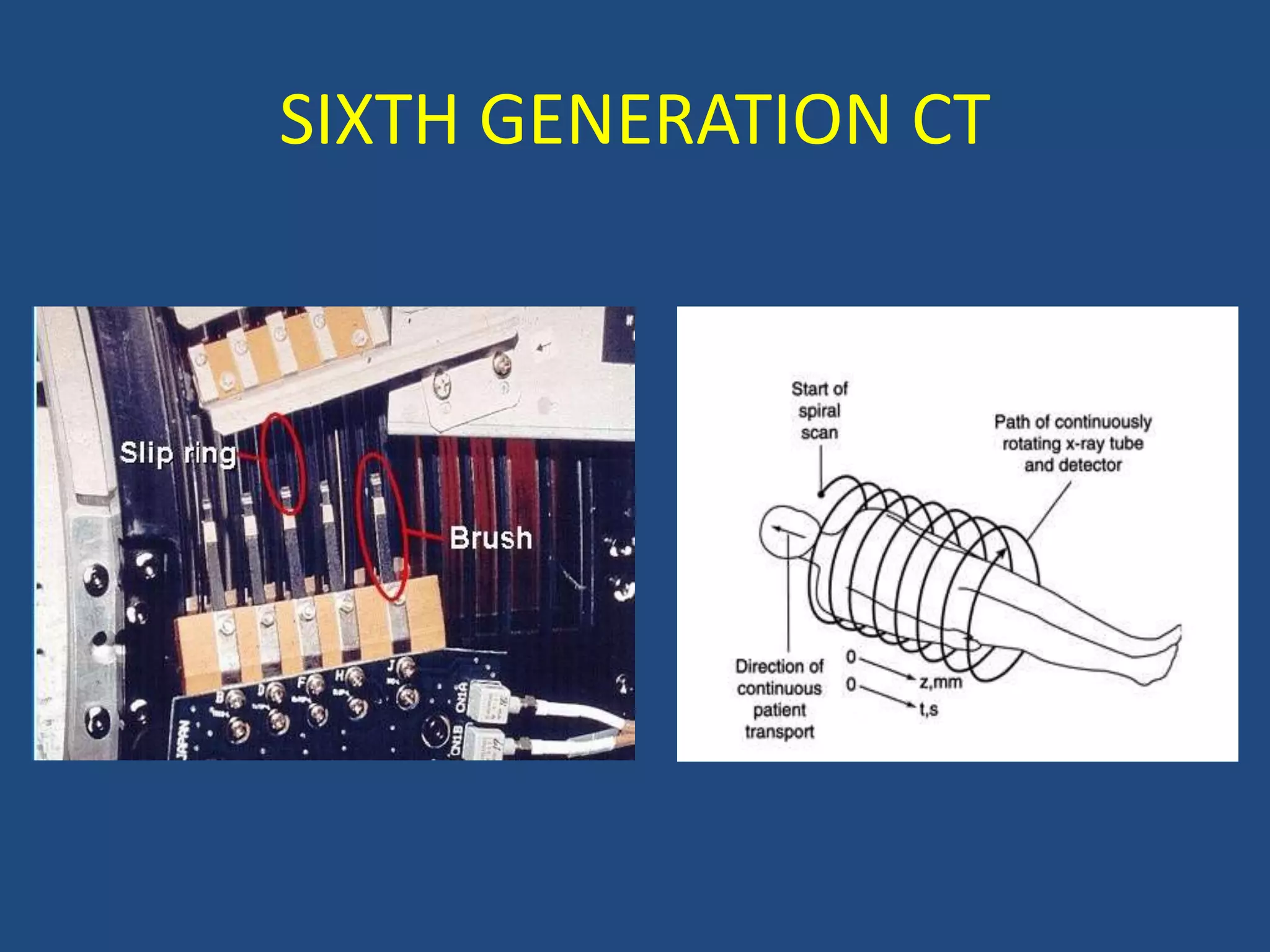 CT Generation (Generation of CT) | PPTX