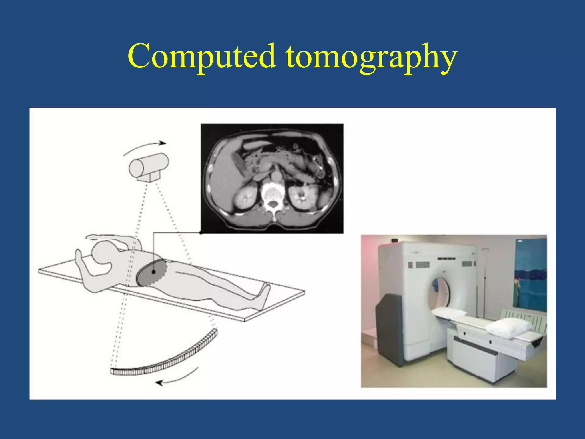 CT Generation (Generation of CT) | PPTX