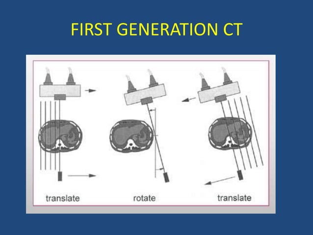 CT Generation (Generation of CT) | PPTX | Medical Tests | Medical Health