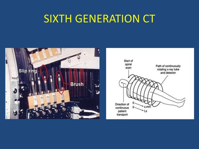 CT Generation (Generation of CT) | PPTX | Medical Tests | Medical Health