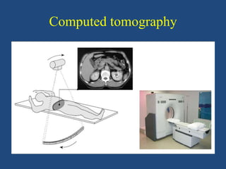 CT Generation (Generation of CT) | PPTX