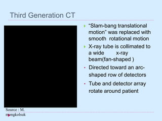 CT generations and peculiarities | PPTX