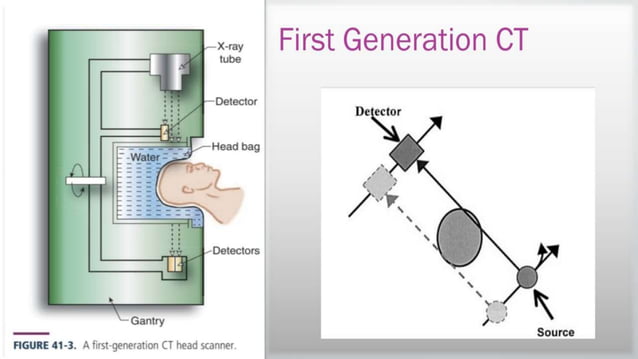 CT Generations 1.pptx | Medical Tests | Medical Health